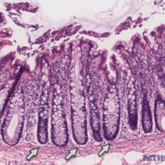 Lieberkühn-Krypten - DocCheck Flexikon