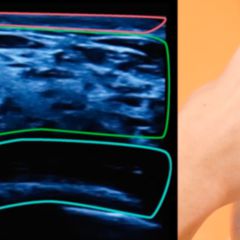 Mammasonographie - DocCheck Flexikon
