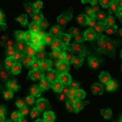 Nuclei pretectales - DocCheck Flexikon