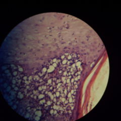 Leishmaniose (Hund) - DocCheck Flexikon