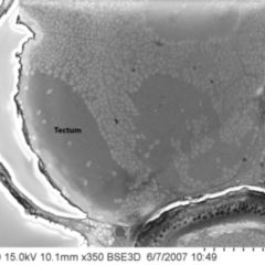 Tectum - DocCheck Flexikon