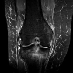 Ligamentum interosseum scapholunatum - DocCheck Flexikon