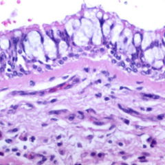 Merokrin - DocCheck Flexikon
