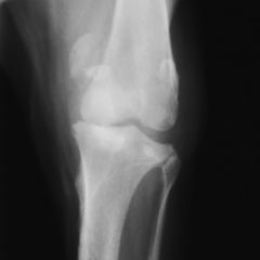 Sesambein - DocCheck Flexikon