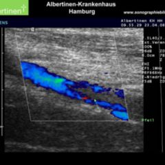 Beinvene - DocCheck Flexikon