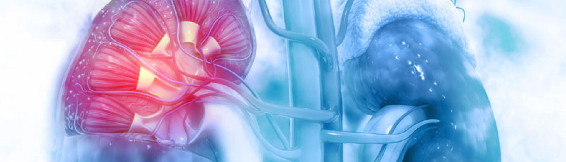 Neu: Oxlumo bei primärer Hyperoxalurie Typ 1 (PH1) - DocCheck