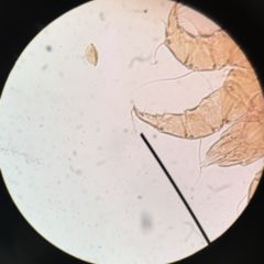 Psoroptidae - DocCheck Flexikon