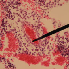 Lymphoretikulär - DocCheck Flexikon