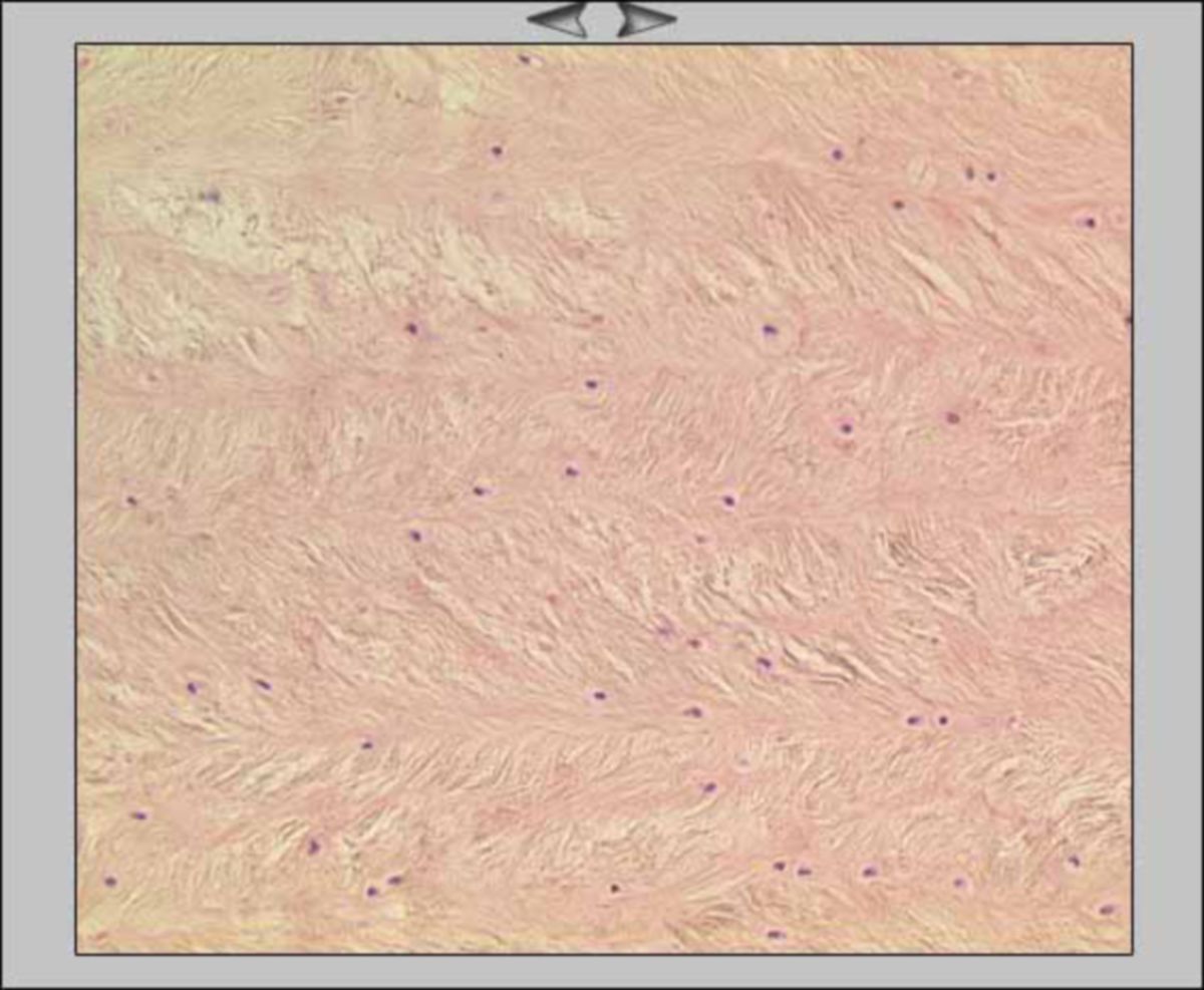 Faserknorpel 10x - DocCheck