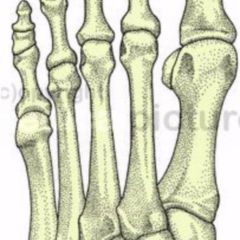 Jackson-Position - DocCheck Flexikon