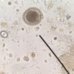 Spulwurm - DocCheck Flexikon