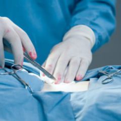 Antisepsis - DocCheck Flexikon