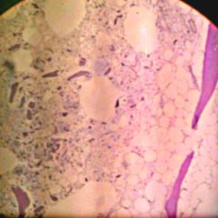 Lieberkühn-Krypten - DocCheck Flexikon