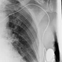 Dislokation - DocCheck Flexikon