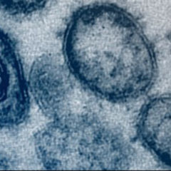 Helikase - DocCheck Flexikon