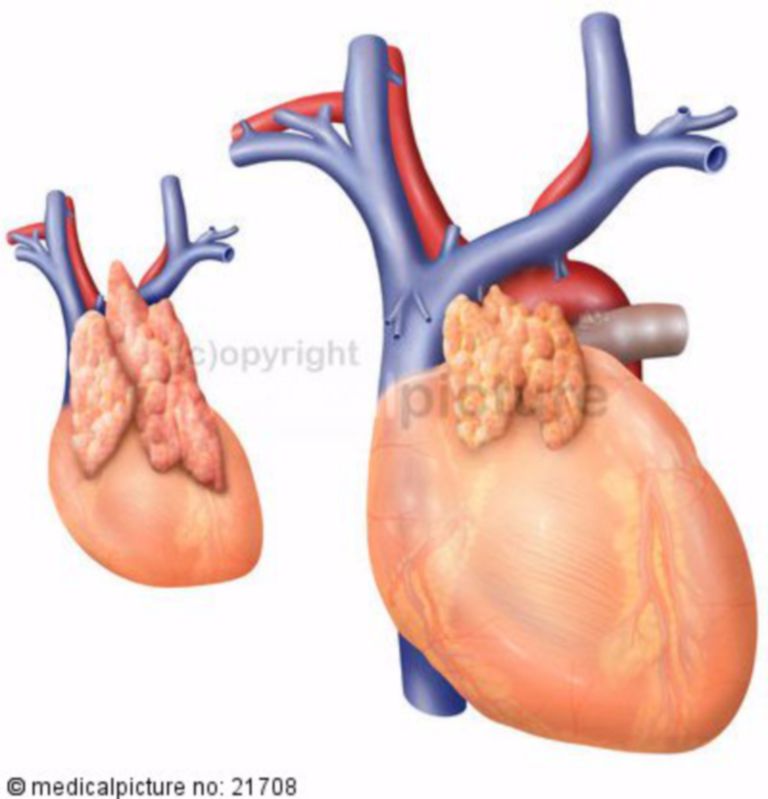 Thymus in Children and Adults in Comparison - DocCheck