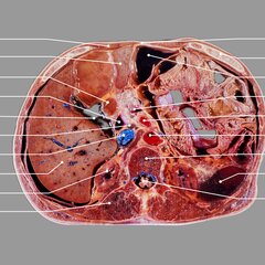Linea alba (Anatomie) - DocCheck Flexikon