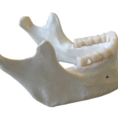 Corpus mandibulae - DocCheck Flexikon