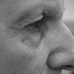 Neurofibrille - DocCheck Flexikon