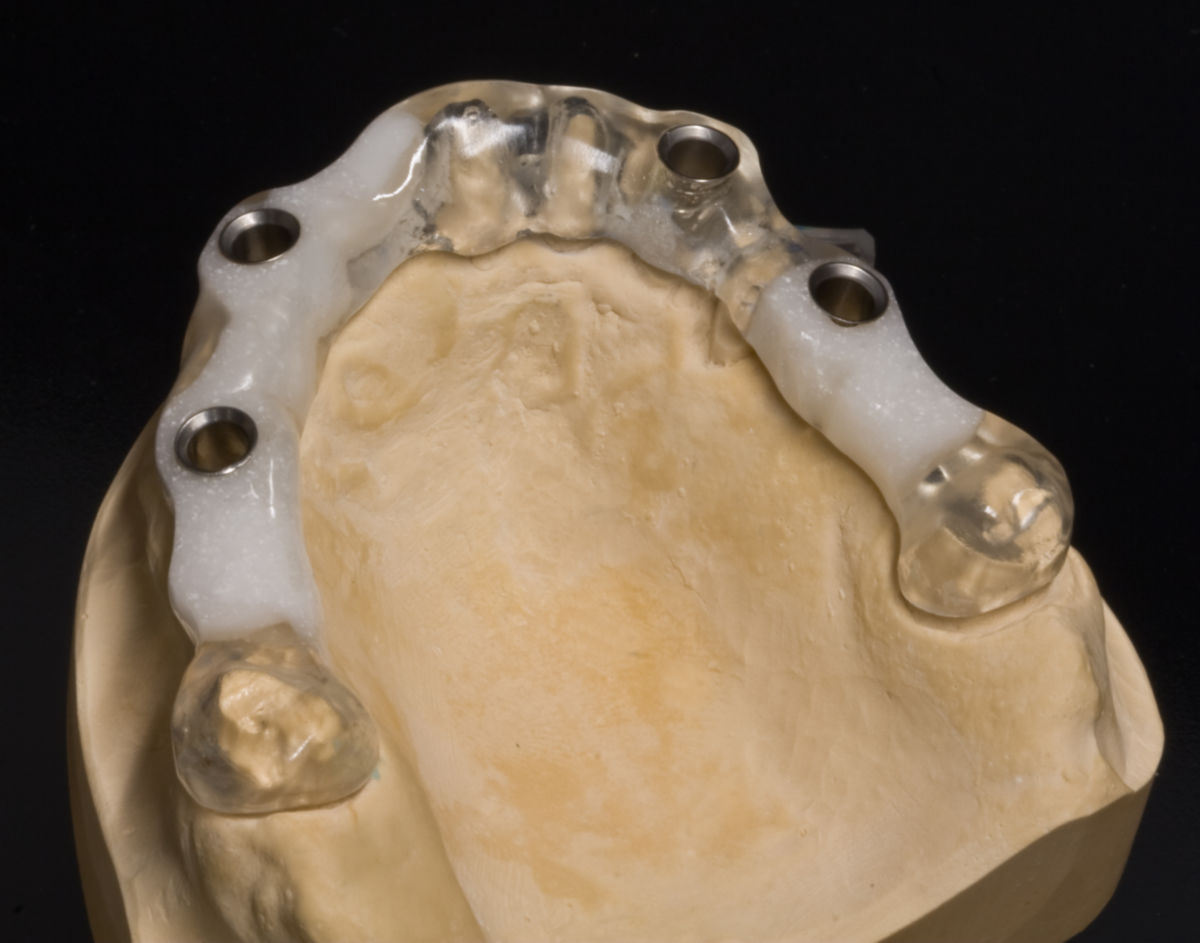 Drilling template - DocCheck