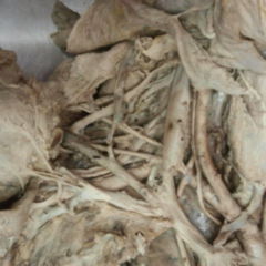 Truncus sympathicus - DocCheck Flexikon