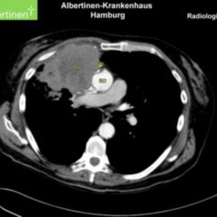 Bronchial - DocCheck Flexikon