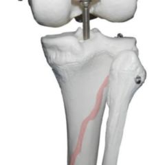 Linea musculi solei - DocCheck Flexikon