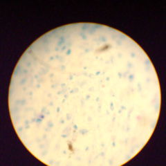 Mycobacterium gordonae - DocCheck Flexikon