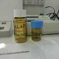Alanin-Aminotransferase - DocCheck Flexikon
