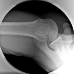 Normvariante - DocCheck Flexikon