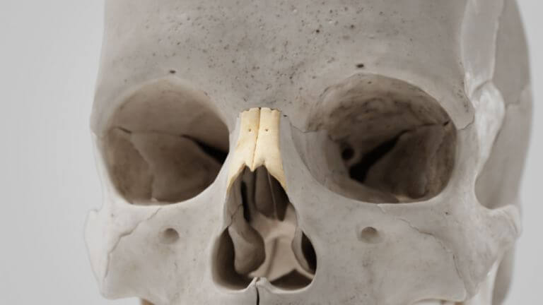 Os nasale - Close-Up - DocCheck