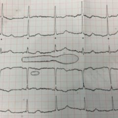 EK - DocCheck Flexikon