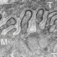 Motorische Endplatte - DocCheck Flexikon