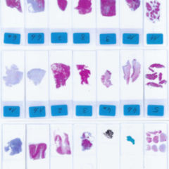 Pathologie - DocCheck Flexikon