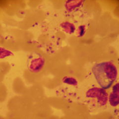 Leishmania infantum - DocCheck Flexikon