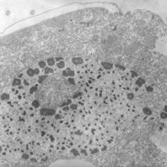 Nucleolus-Organisator-Region - DocCheck Flexikon