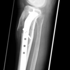 Tibia - DocCheck Flexikon