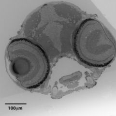 Tectum - DocCheck Flexikon