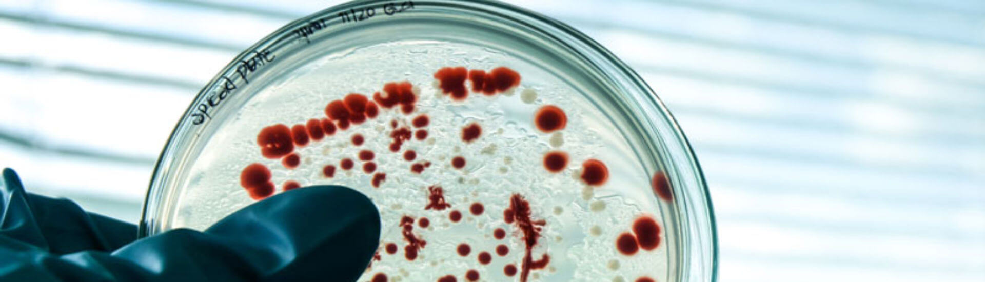 Neueinführung: Antibiotikum Fetcroja® - DocCheck