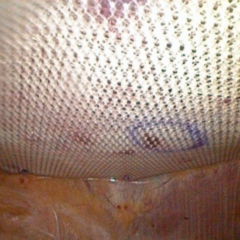 Netzmagen - DocCheck Flexikon