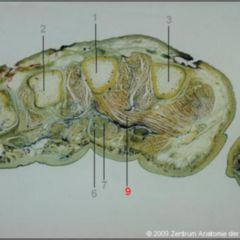 Sehne - DocCheck Flexikon