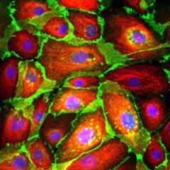 Epithelzelle - DocCheck Flexikon