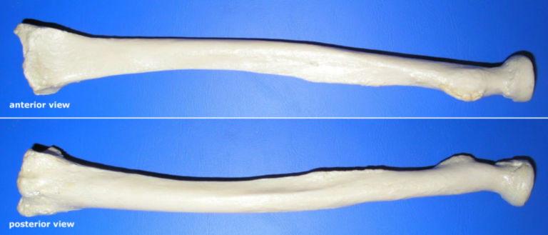 Radius (Speiche) - DocCheck