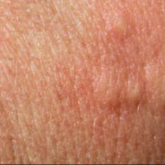 EA - DocCheck Flexikon