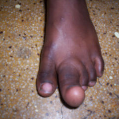 Akre - DocCheck Flexikon