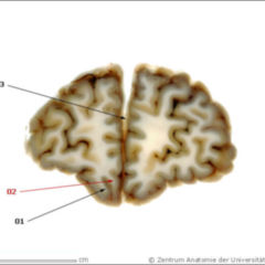 Os rostrale (Veterinärmedizin) - DocCheck Flexikon