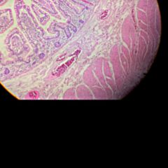 Krypte - DocCheck Flexikon