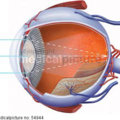 Visusverlust - DocCheck Flexikon