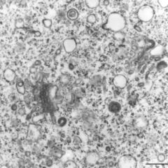 Dictyosom - DocCheck Flexikon