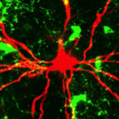 Gliazelle - DocCheck Flexikon